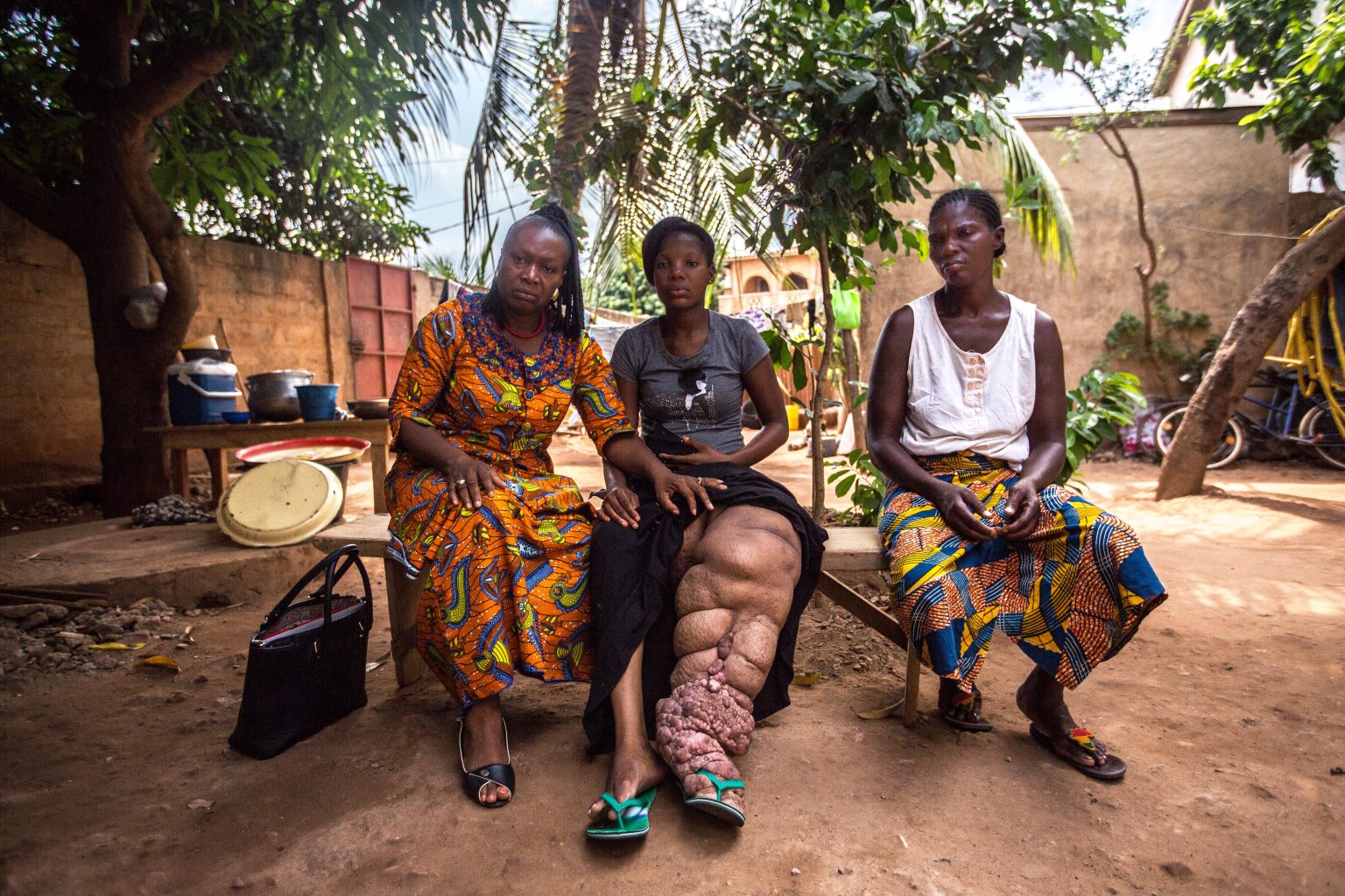 The world's most neglected diseases, affect women the most ⋆ Speak Up ...